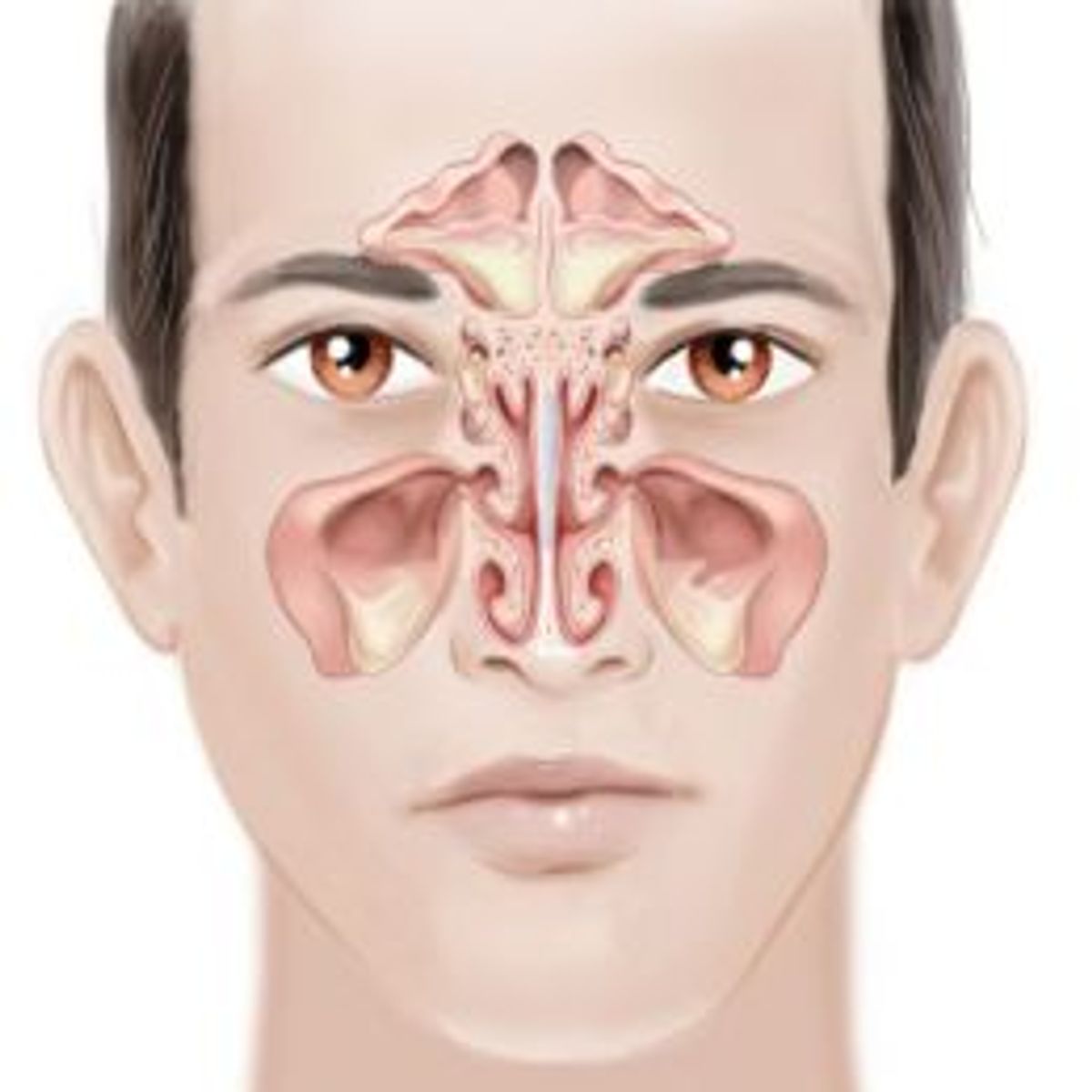 Sinüs iltihaplanması - Op. Dr. Ayfer Ulçay